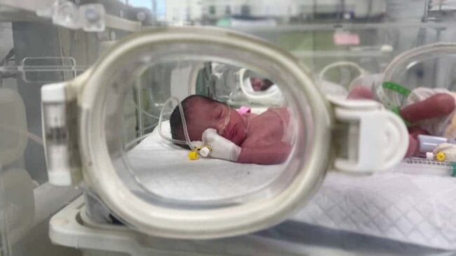 Gaza doctors deliver baby girl from mother killed in Israeli airstrike